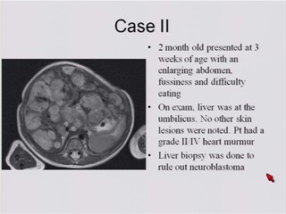 An international randomized phase III trial comparing radical ...