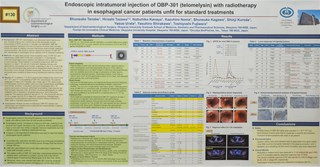 A new complementary approach to endoscopy for esophageal cancer ...