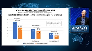 RTOG 9804: A prospective randomized trial for “good risk” ductal ...